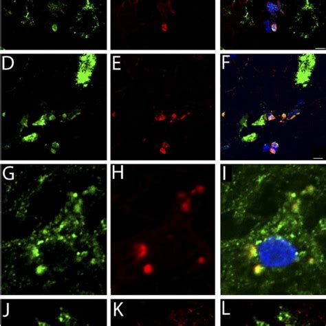 Annular Protofibrils Are On A Distinct Pathway From Amyloid Fibril Download Scientific Diagram