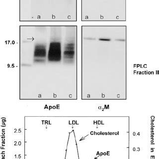 Purity Of Crude HDL HDL And HDL As Demonstrated By Agarose Gel Download Scientific