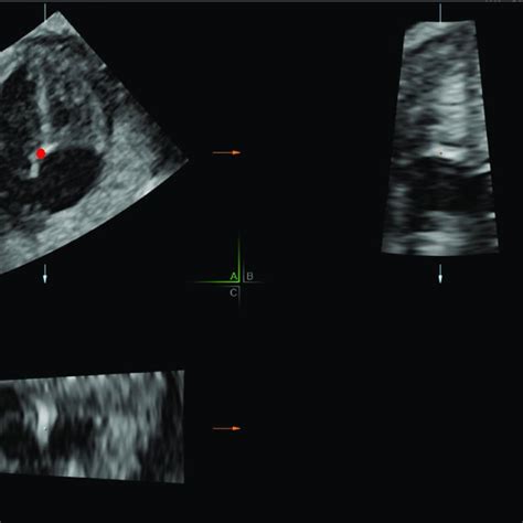 Multiplanar Display Of A 4d Spatio Temporal Image Correlation Stic Download Scientific