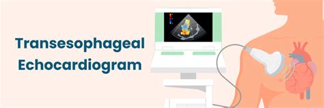 Transesophageal Echocardiogram