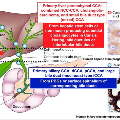 Cholangiocarcinoma Staging