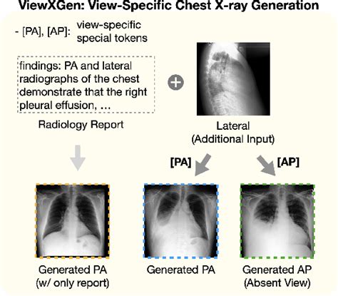Unified Chest X Ray And Radiology Report Generation Model With Multi View Chest X Rays