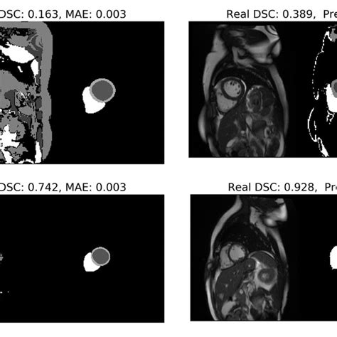 Examples Showing Excellent Prediction Of Dice Similarity Coefficient Download Scientific