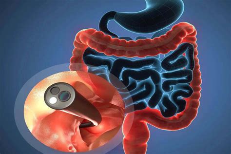 Colonoscopy Test In Nagercoil Kanyakumari