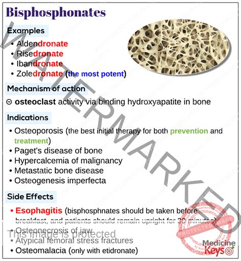 Bisphosphonates Medicine Keys For Mrcps
