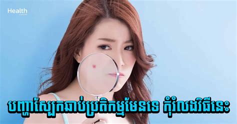 លែង បារម្ភ ហើយ បញ្ហា ស្បែក ឆាប់ ប្រតិកម្ម មែន ទេ កុំ រំលង វិធី នេះ