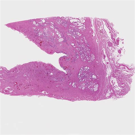Human Prostate Gland Young Sec 7 µm Hande Microscope Slide