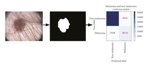 Confusion Matrixs Diagram Of A Test Sample Of Skin Lesion Image The Download Scientific