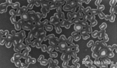 载二氧化硅 硅蛋白多孔微球 胶原蛋白 壳聚糖 纳米sio2复合微球的制备 知乎