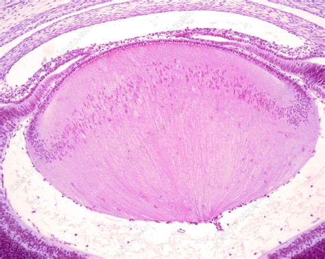 Lens Fibres Light Micrograph Stock Image C059 4847 Science Photo Library