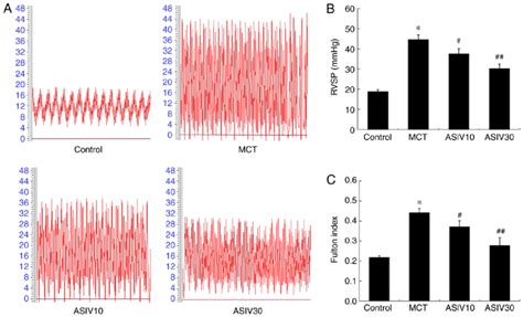 ASIV Attenuates Pulmonary Arterial Pressure And RV Hypertrophy A Download Scientific Diagram