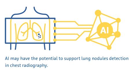Ai In Lung Cancer Diagnosis And Screening