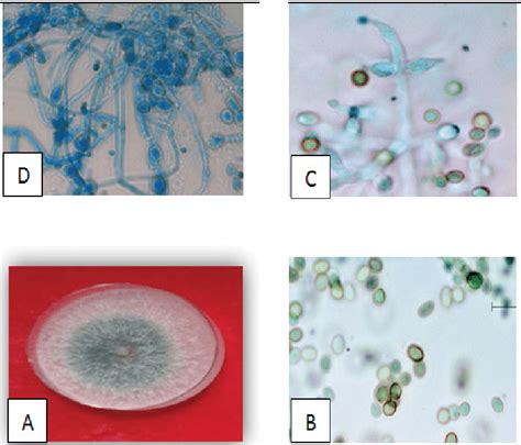Micromorphology Of Trichoderma Asperellum Isolate 4 Trichoderma Micromorphology Of Trichoderma Asperellum Isolate 4 Trichoderma