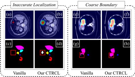 [论文审查] Cnn Transformer Rectified Collaborative Learning For Medical Image Segmentation