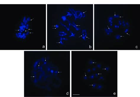 Chromosomes After Dapi Staining A Metaphase I In Cirrorhynchus Download Scientific Diagram