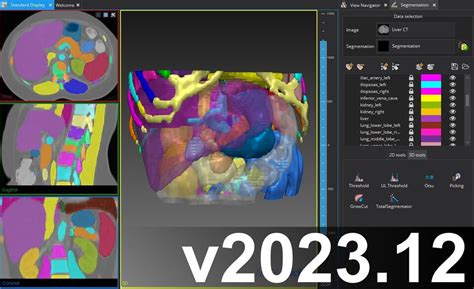 The Medical Imaging Interaction Toolkit Mitk