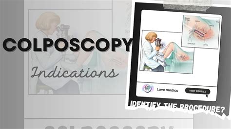 What Is Colposcopy The Diagnostic Procedure Colposcope