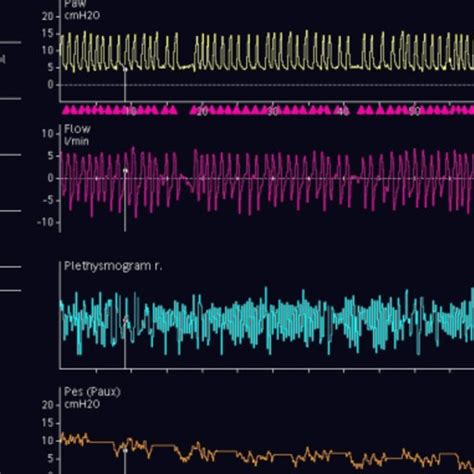 Gokhan Ceylan Postdoc Position Doctor Of Medicine Pediatric