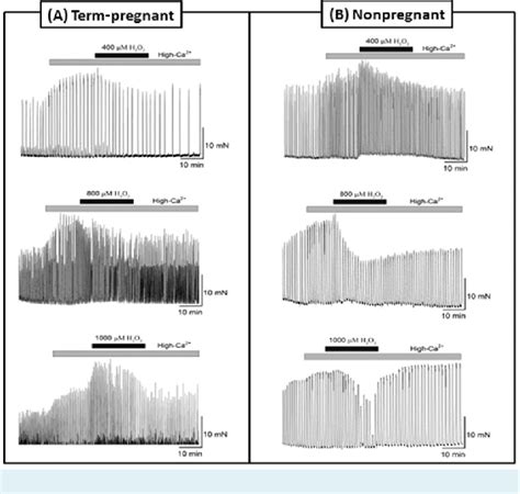 Original Recordings Showing The Contractile Responses Of Uterine Strips Download Scientific