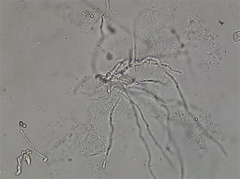 Candida Albicans Introduction Morphology Pathogenicity Lab