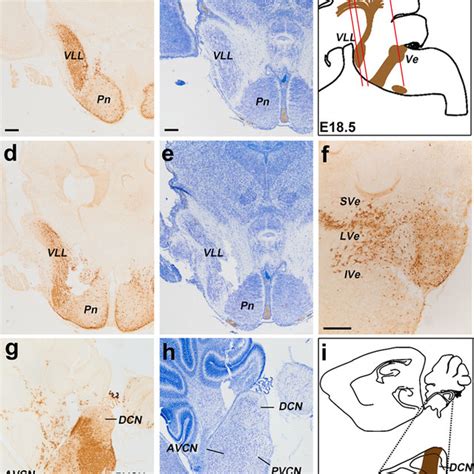 Detail Of R4 Derived Parts Of Lemniscal Cochlear And Vestibular Nuclei Download Scientific