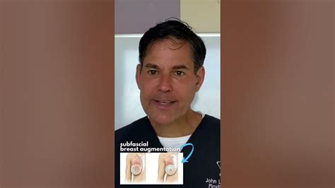 Breast Implant Issues Animation Deformity Youtube