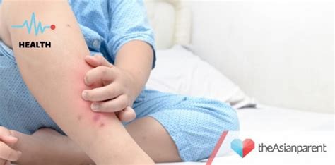 Kagat Ng Daga At Iba Pang Hayop Mga Kailangang Tandaan