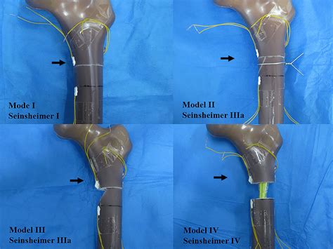 Photos Of A Specimen Representing The Four Fracture Models For Testing Download Scientific