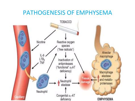 Emphysema Pptx