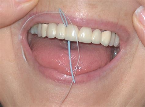 Floss Picks And Floss Holders News Dentagama