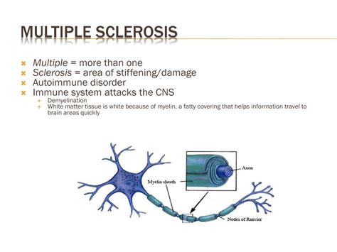 Ppt Multiple Sclerosis And Neuropsychological Functioning Managing
