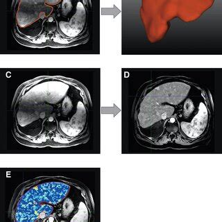 Image Processing Workflow Download Scientific Diagram