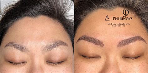 Eyebrow Mapping And Symmetry Fixing Uneven Brows Xobrows