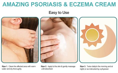 Bio Md Psoriasis Eczema Cream Eczema Cream For Adults Extra Strength Control