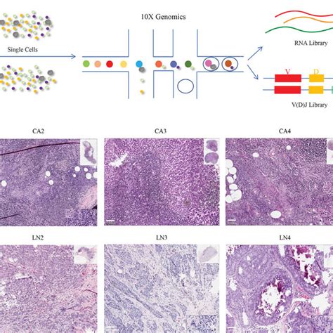 Single Cell Rna And Tcr Analysis Of Primary Breast Tumors And Paired