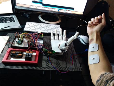 youbionic s fascinating 3d printed bionic hand fabbaloo