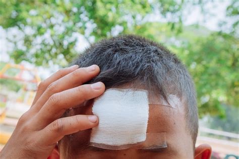 Laceration Head