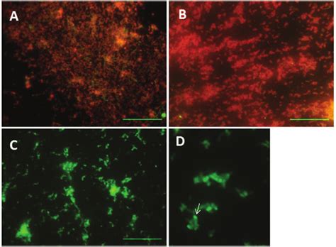 Estimation Of The Viability Of B Subtilis Bacterial Cells Within The