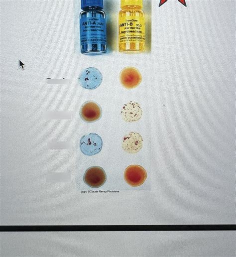A P Lab Quiz 2 Testing For Blood Type Diagram Quizlet