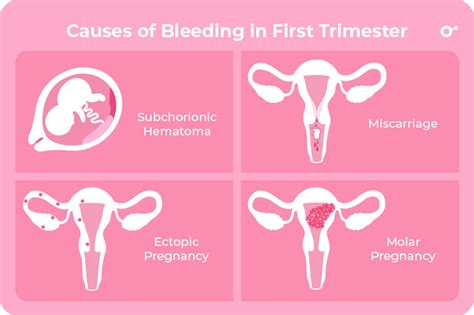 Can Implantation Bleeding Throw Off A Pregnancy Test At John Parsons Blog