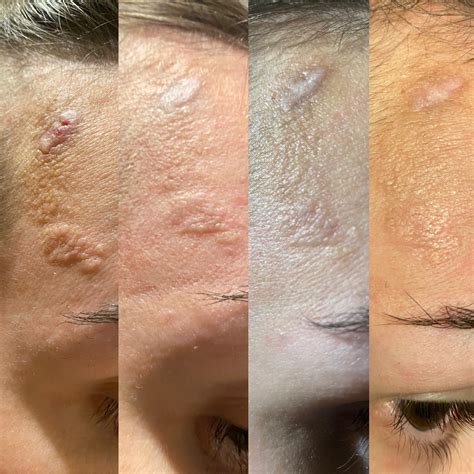 Duct Tape Works Rwarts