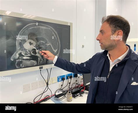 Mr Anastasios Giamouriadis A Consultant Neurosurgeon At Nhs Grampian Has Adapted An Existing