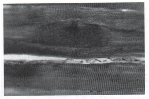 Trigger Points Flashcards Quizlet