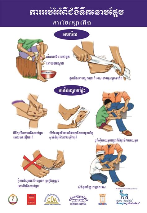 Diabetic Foot Care Education Handout At Alan Matheny Blog