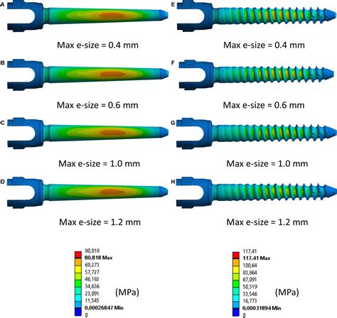 Frontiers Patient Specific Finite Element Models Of Posterior Pedicle Screw Fixation Effect