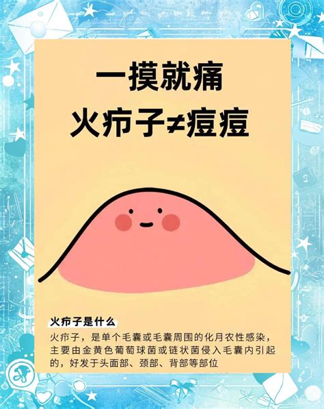 火疖子是什么？