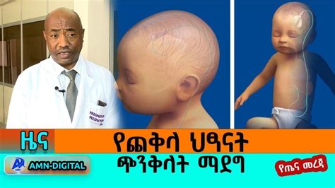 የጨቅላ ህፃናት ጭንቅላት ማደግ Youtube