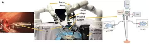 Autonomous Robotic Laparoscopic Surgery For Intestinal Anastomosis United States