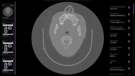 Deploying Ai Models At Scale With An Operating System For Smart
