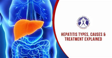 Hepatitis Types Causes And Treatment Explained Regency Medical Centre